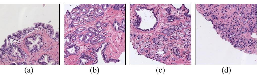 Histology regions of prostate biopsies. (a): region