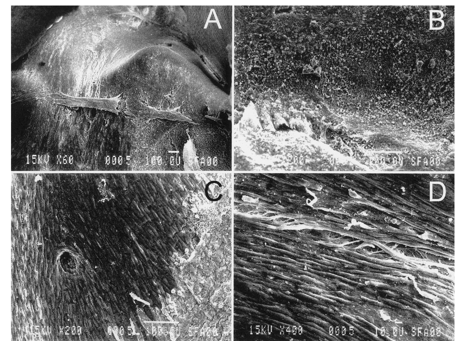 @ sems of the luminal surface of an anaconda device