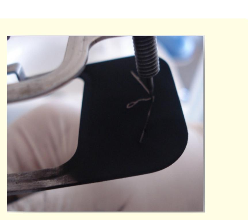 (PDF) An Understanding of Gothic Arch Tracing- A Clinical and Academic ...