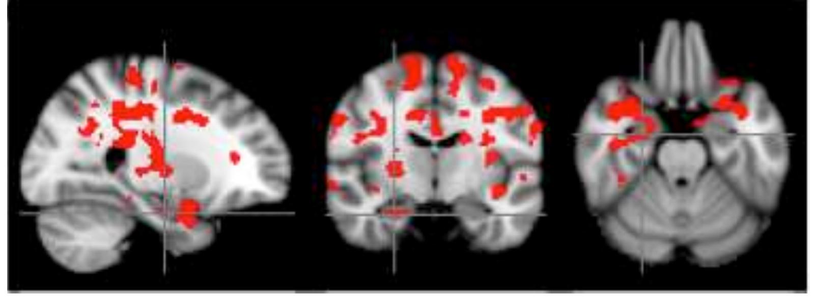 Accumbens and septum (figure 21), and the anterior
