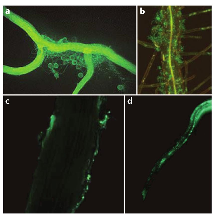 | microorganisms in the rhizosphere. a|arbuscular