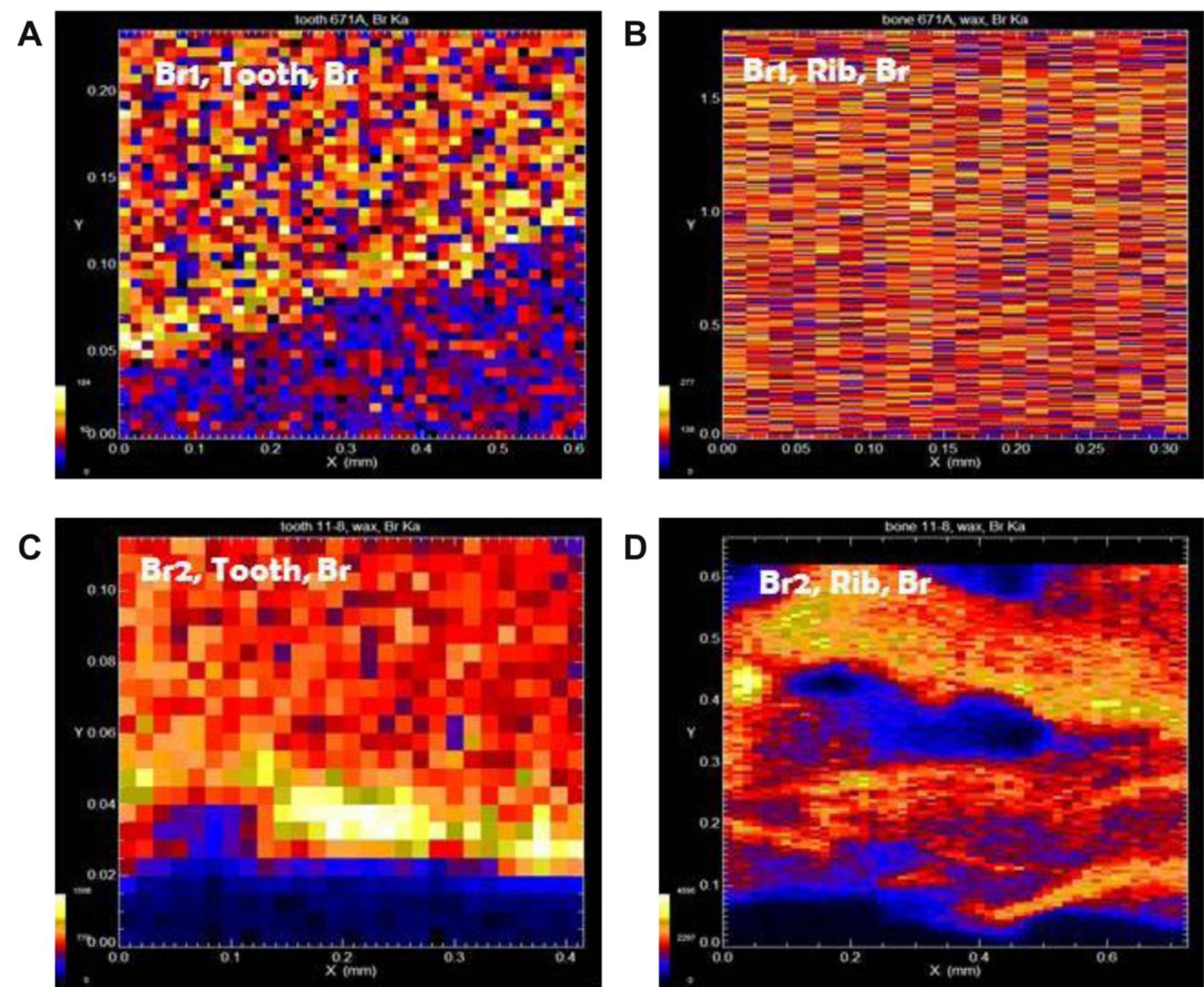 Synchrotron xrf intensity maps of br for bone and tooth