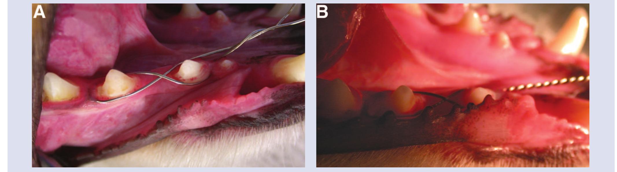 Figure 6 - Correction of Maxillary Canine Tooth Mesioversion