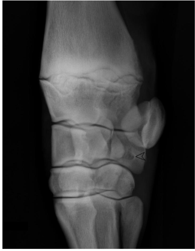 Dorsal (30°—40°) lateral palmar medial oblique radiograph of