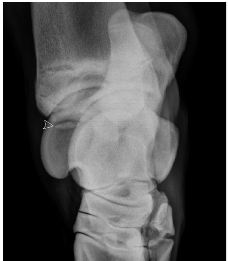 Dorsal 65° medial plantar lateral oblique radiograph of the