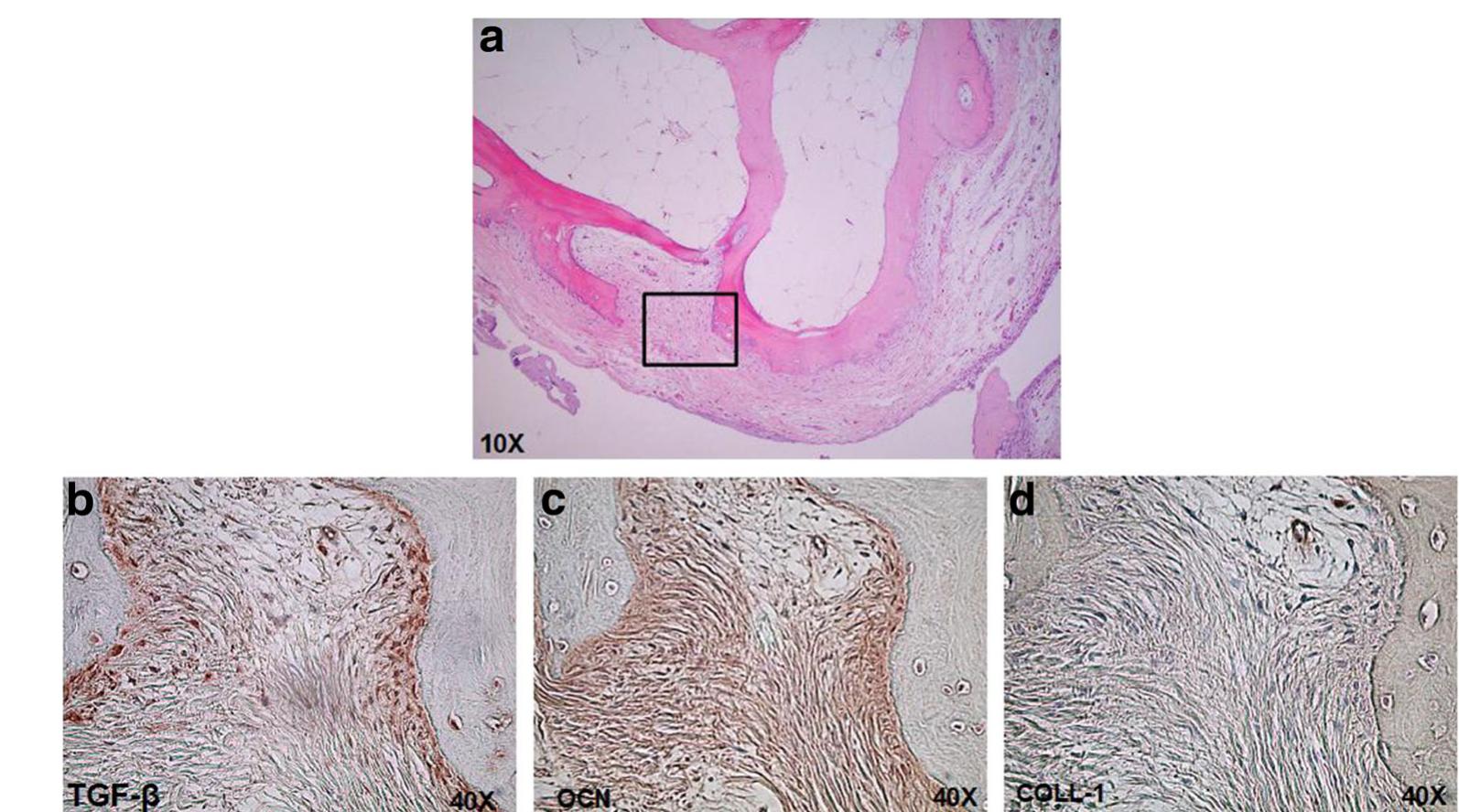 Decreases [29]. thus, in an early phase, the adipose tissue