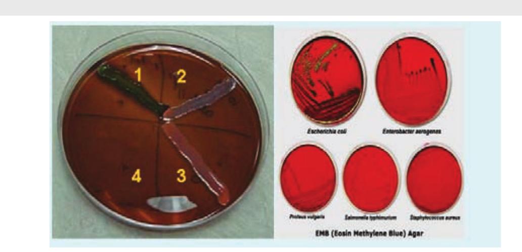 The eosin methylene blue. quadrant 1 : growth on the plate