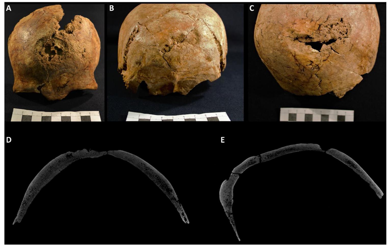 Cranial vault of t. 91: a) frontal bone, anterior view; b)
