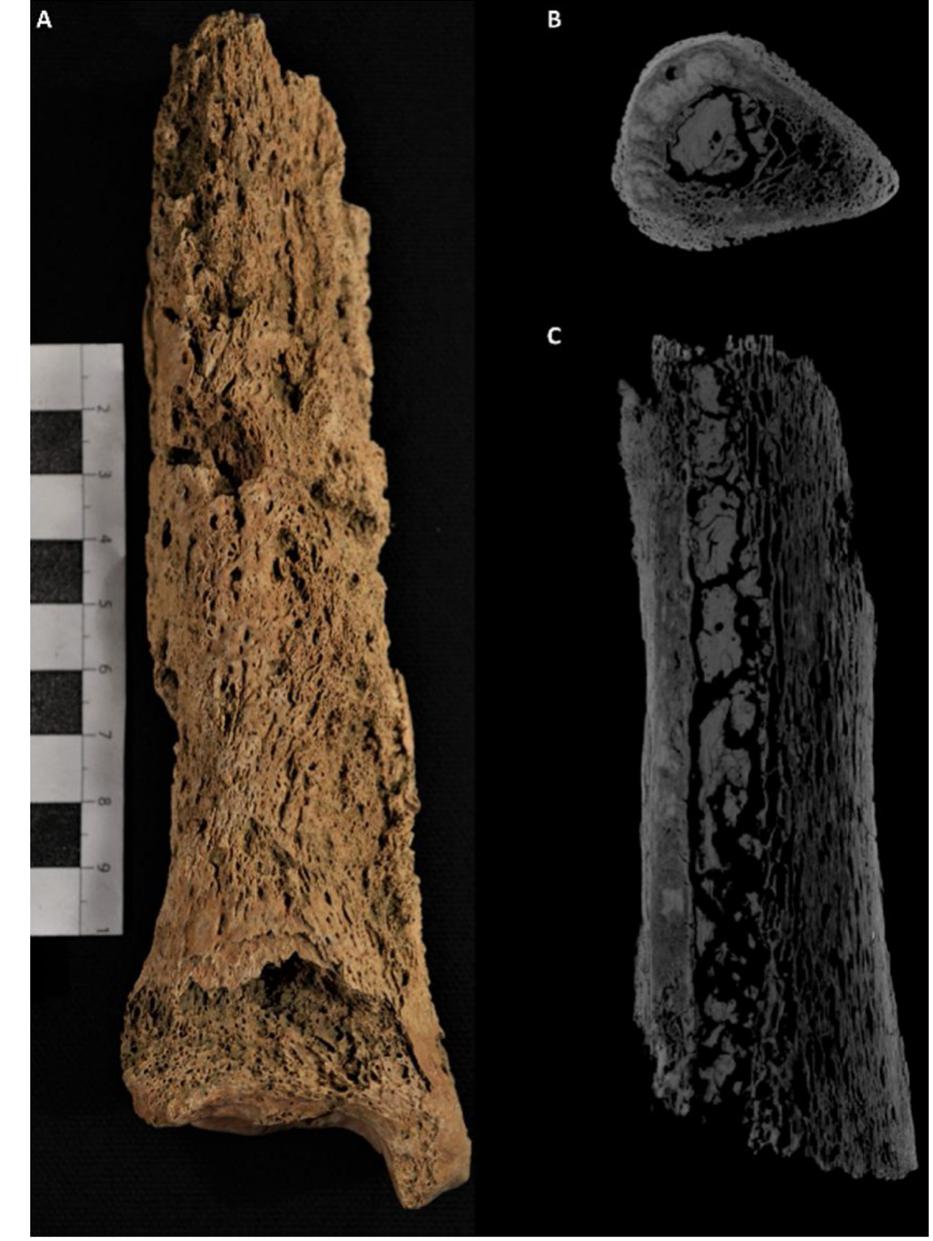 A) distal half of right tibia of t. 170, anterior view; b)