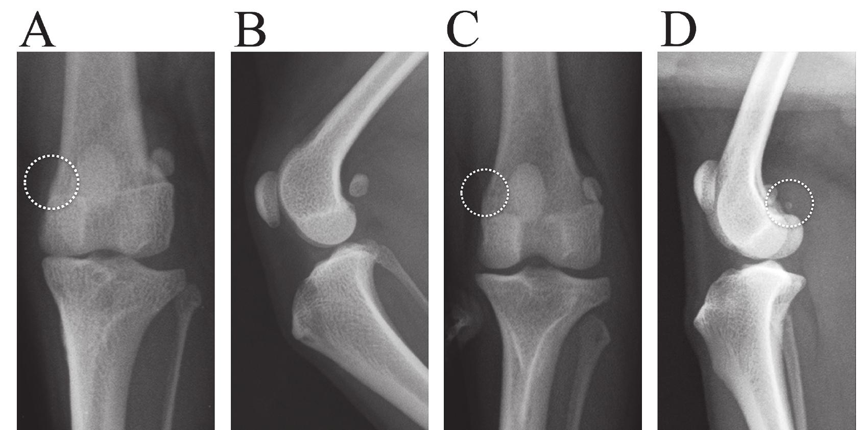 Deformity of the medial fabella. (a) aplasia (craniocaudal