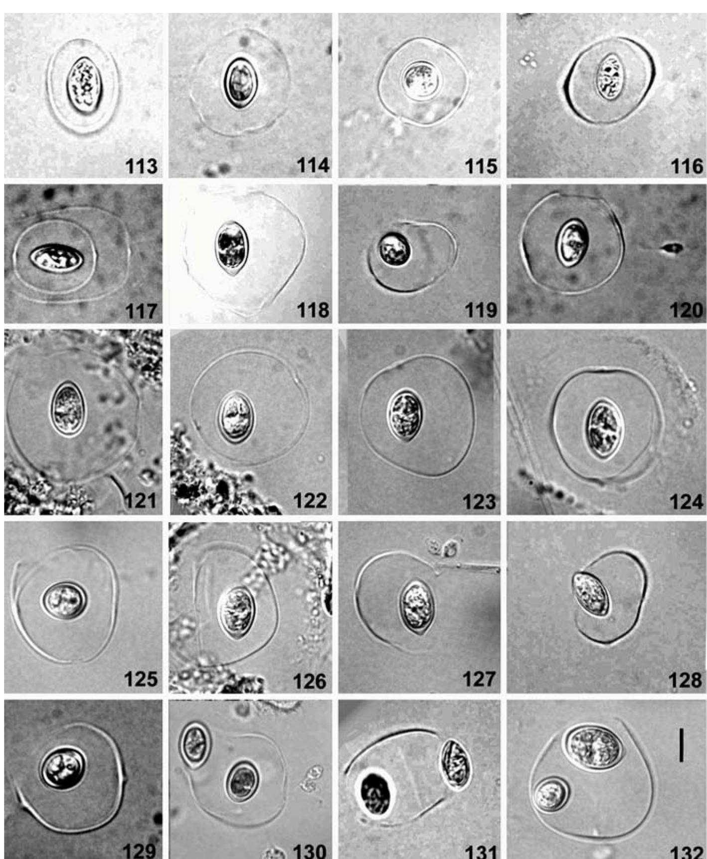 S 113-132: solitary cells and autospores of oocystis