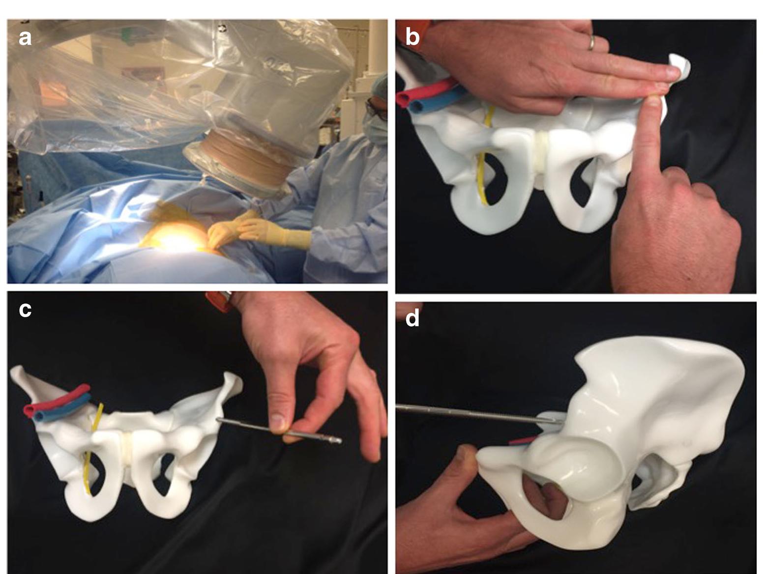 (PDF) Vertical shear pelvic injury: evaluation, management, and ...