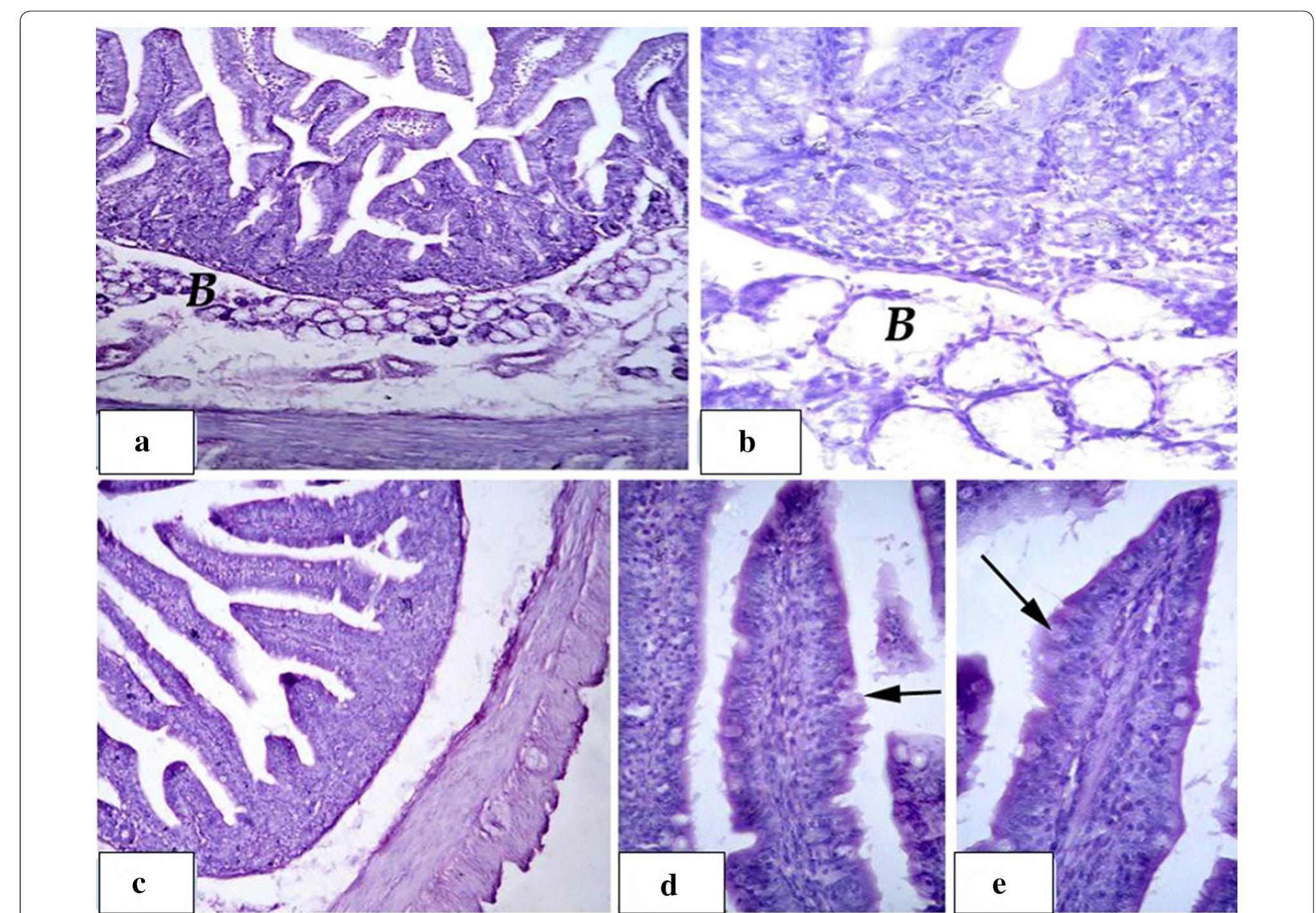 Group t3: a, b showing normal duodenum mucosa and submucosa