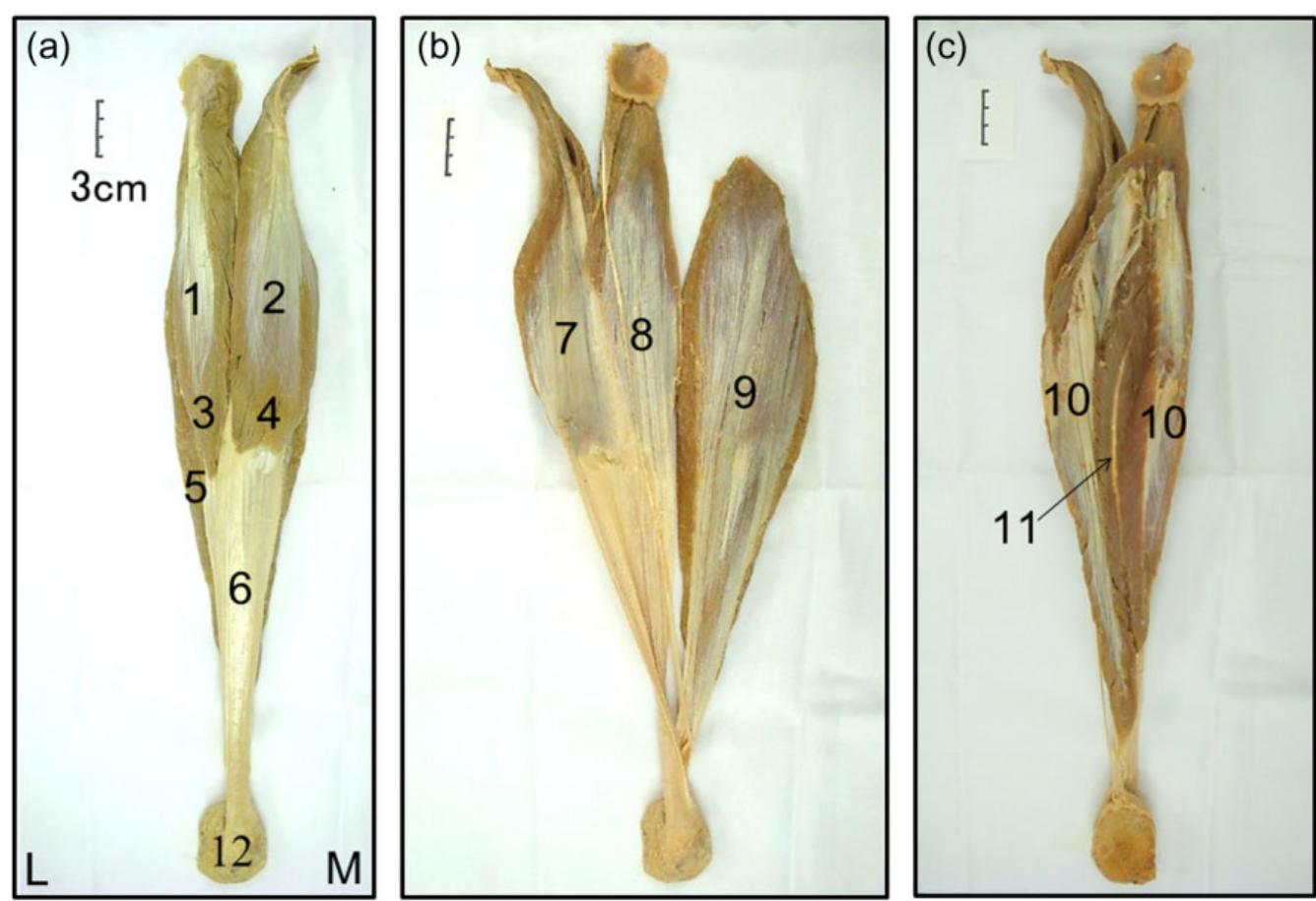 The structure of the left triceps surae. (a) left triceps