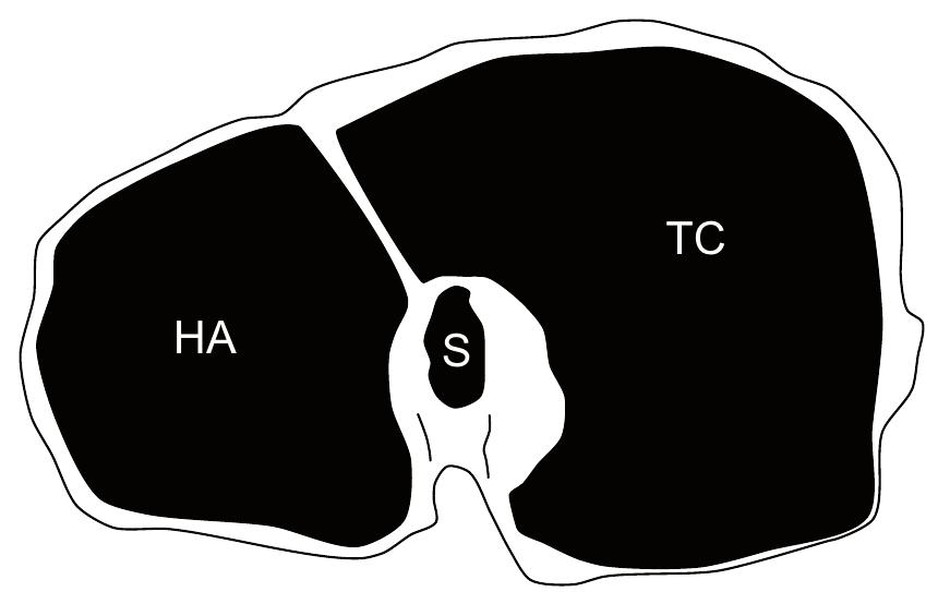 Metacarpal proximal morphology. birger- bohlinia schaubi,