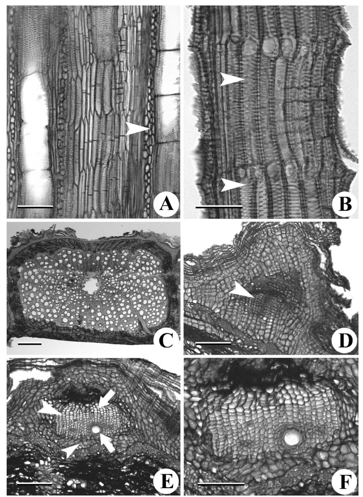 (a-f) tangential (a), radial (b) longitudinal and transverse