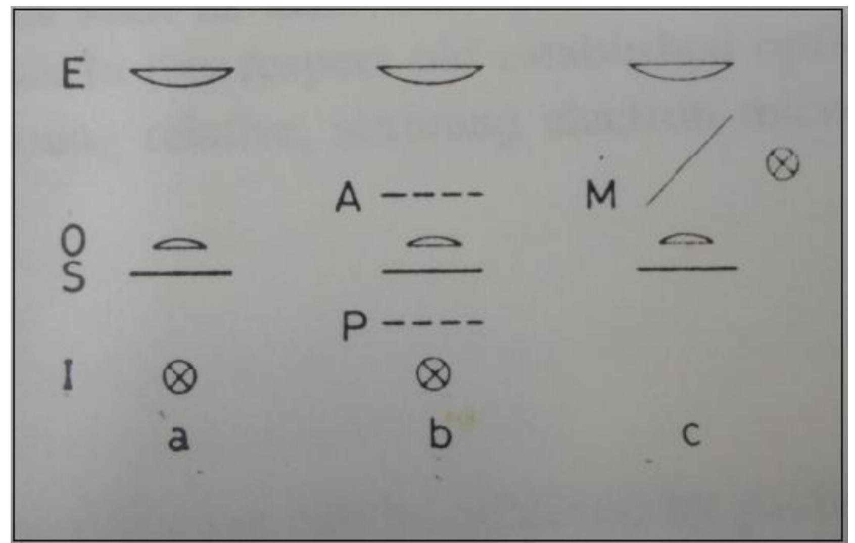 7: schematic drawing of the main components of an ordinary