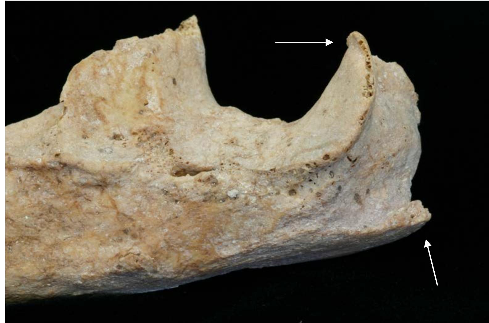 12: burial 1 - medial view, proximal end of the left ulna,