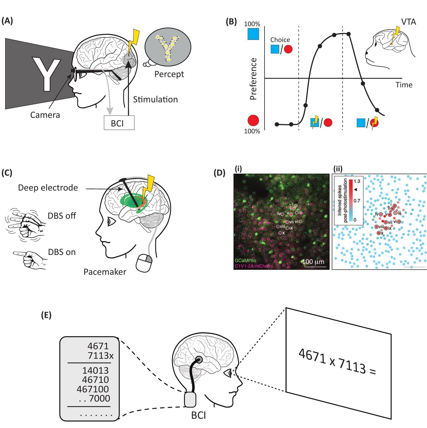 Mind writing. (a) visual prostheses can evoke visual