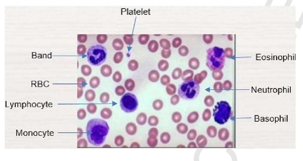 Table 2 - from Peripheral blood smear analysis using image