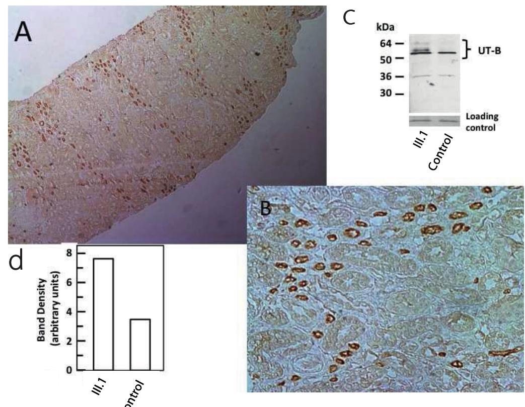 Ut-b expression in the kidney. a) + b) renal biopsy of the