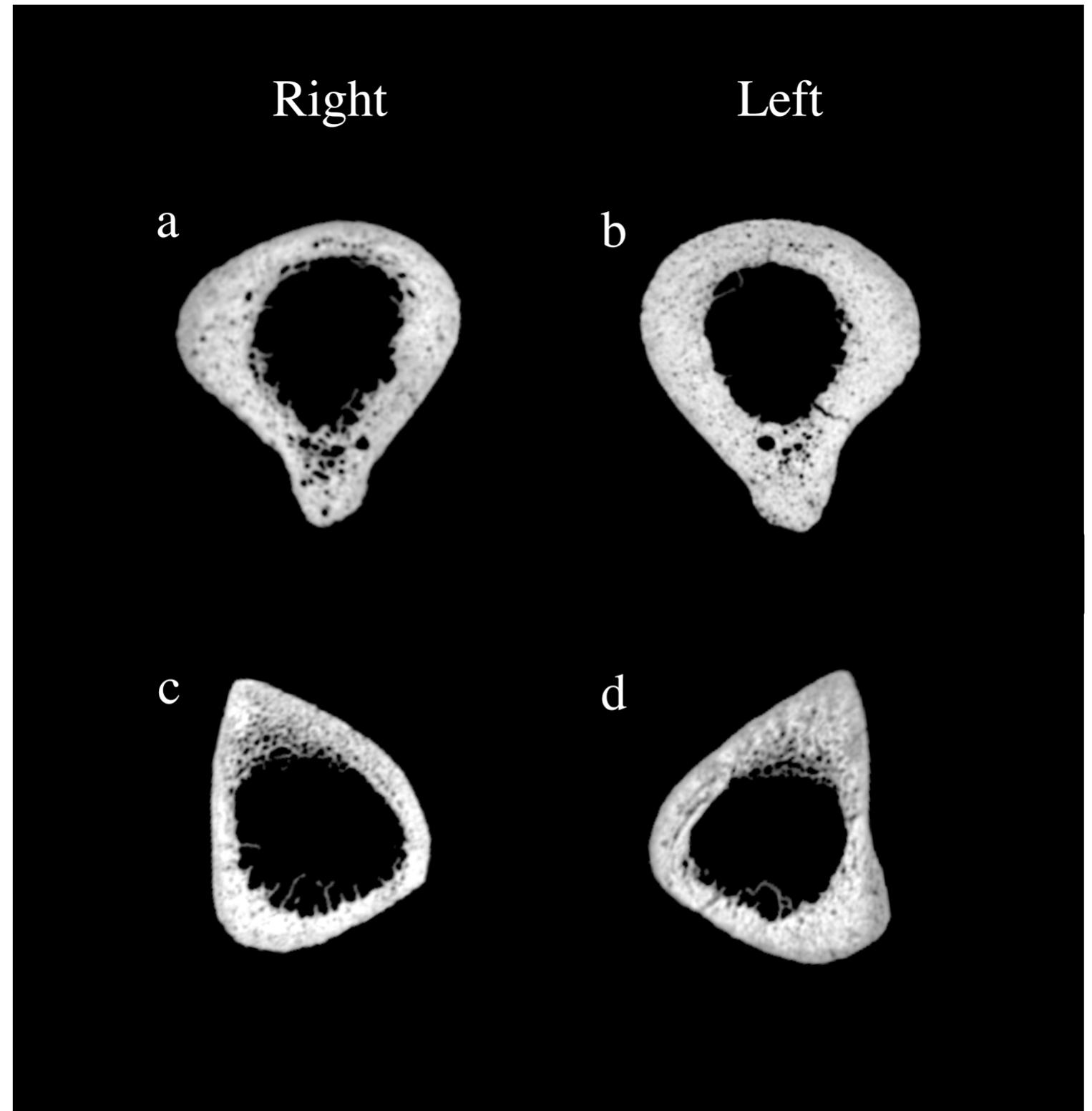 Psn 335 a) 50% cross section of right femur, b) 50% cross