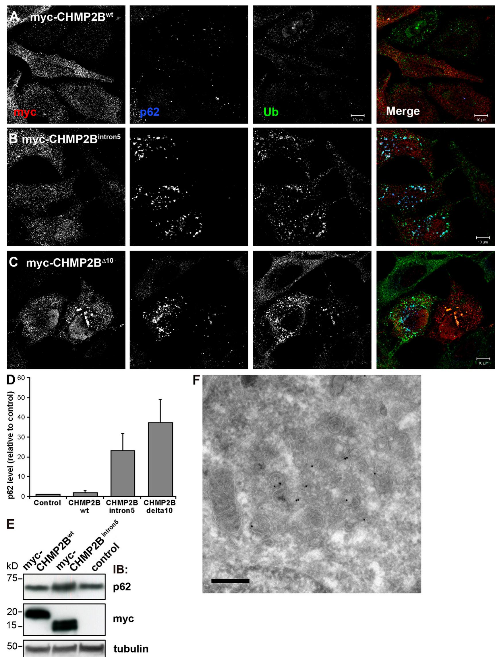 Ubiquitin and p62 positive structures accumulate in cells