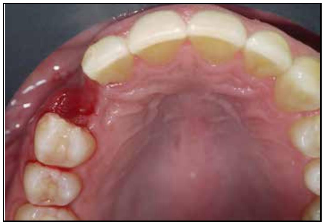 C: occlusal view showing horizontal deficiency.