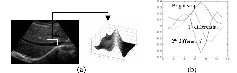 The ultrasonic echoic bright strip (a) and its differentials