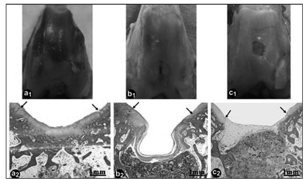 - (ai-c1) gross view and (a2-c2) histological images of the