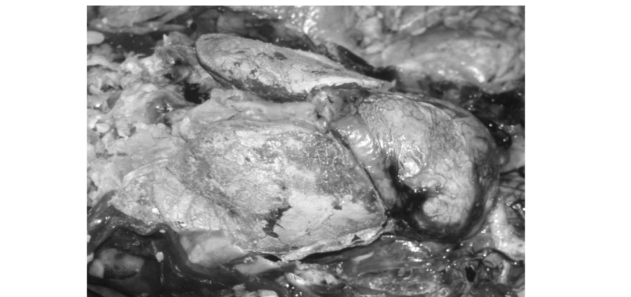 Necropsy photograph of the abdominal cavity of an owbv with