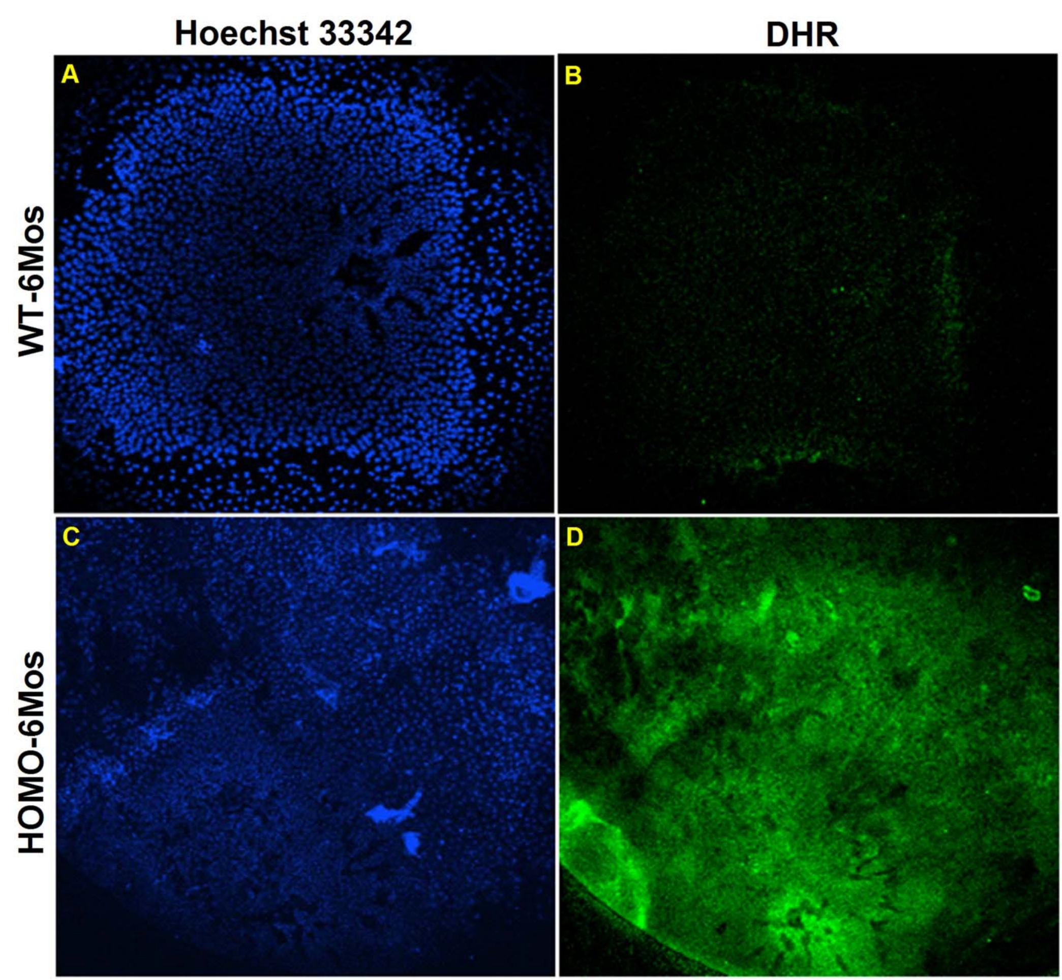 Comparison of lens anterior surfaces of 6 mos wild type and