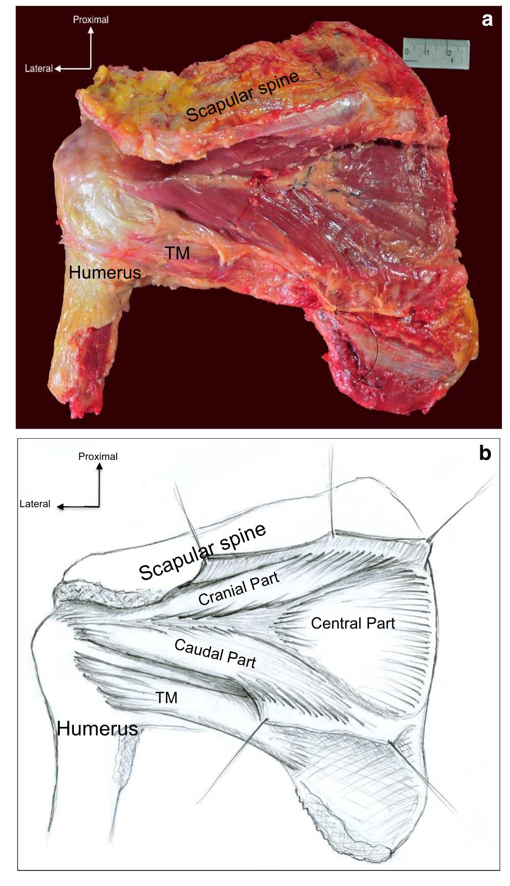 Posterior aspect of muscular rotator cuff. a photograph of a