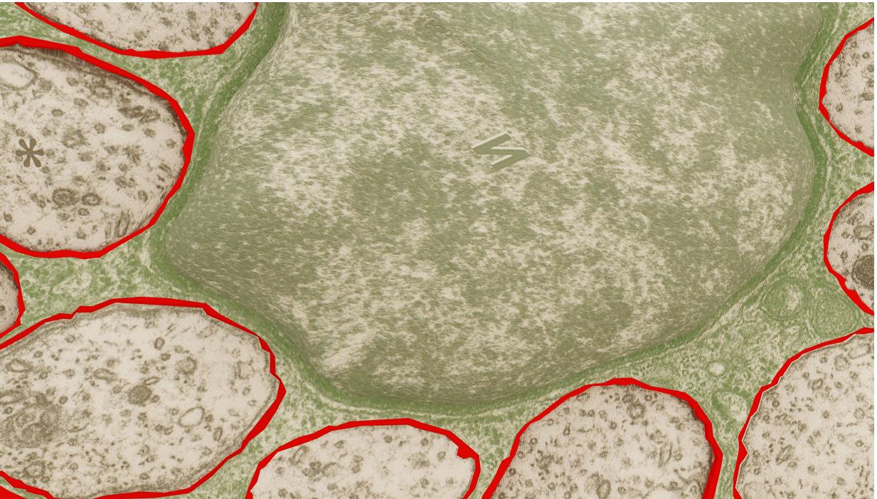 Peri-axonal space in a dorsal root section. the nerve bundle