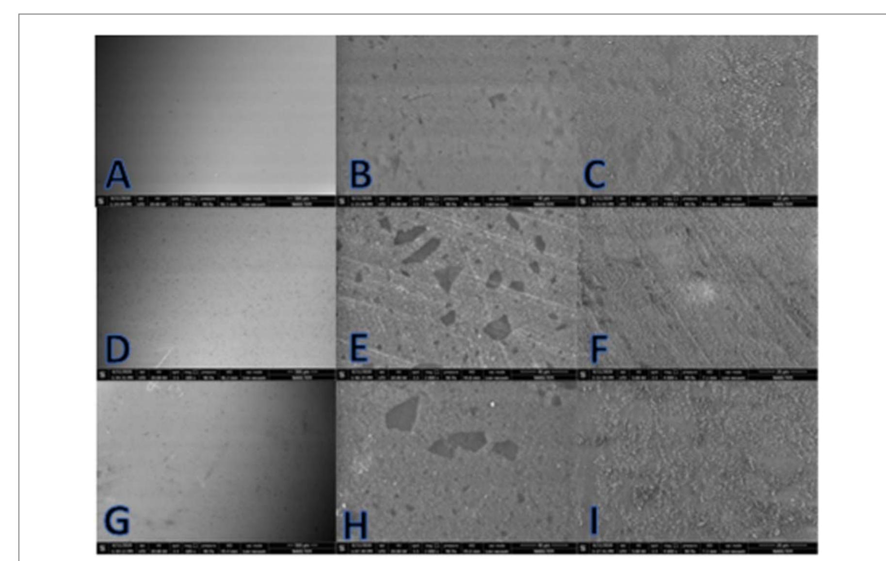 The scanning electron microscopic (sem) images of componeer