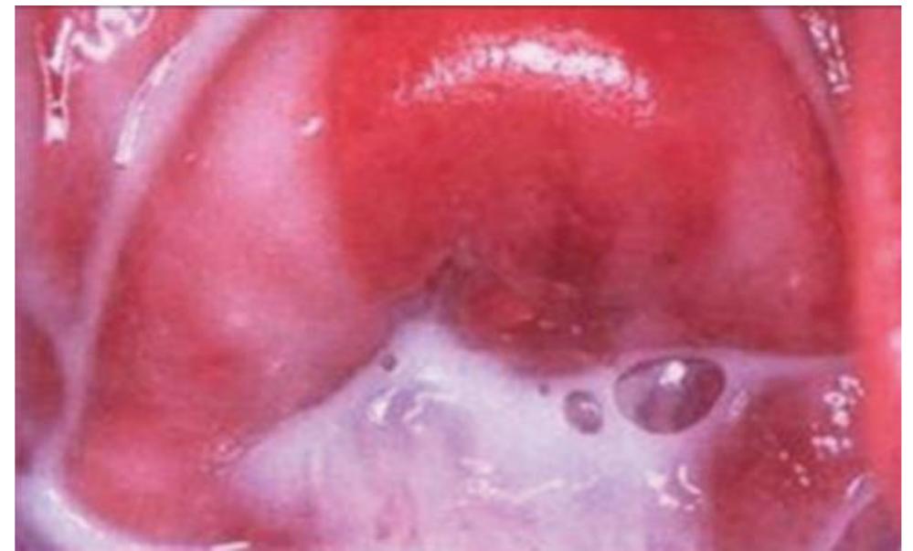 Figure 5 Etiology Diagnosis And Treatment Of Leukorrhea