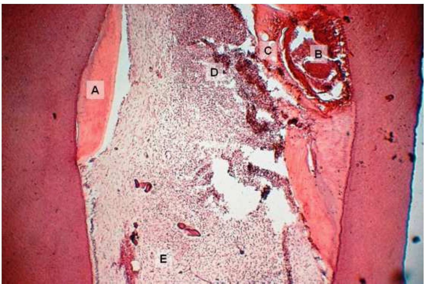 Histologic slide showing many of the elements of pulp