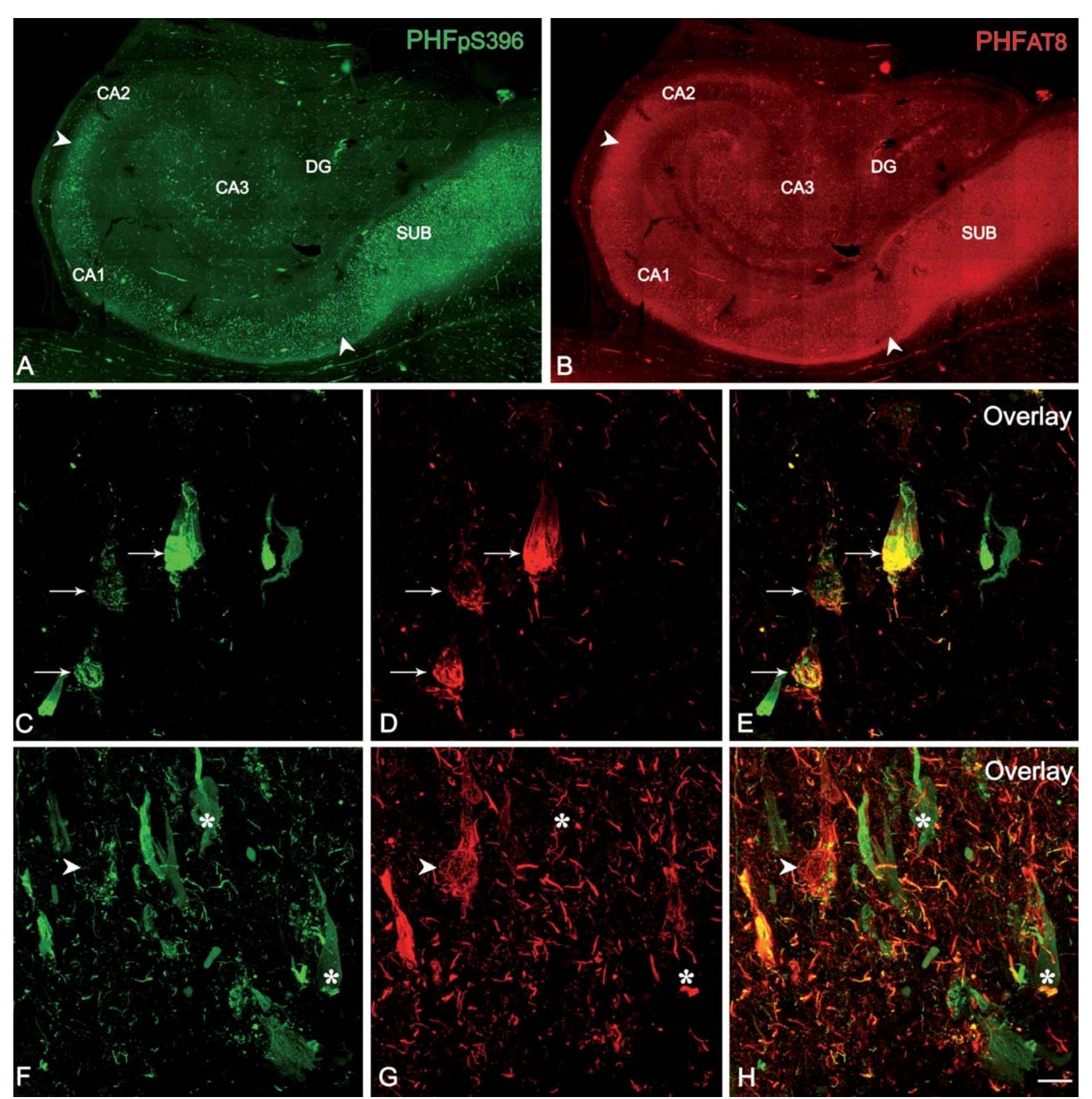 Confocal stack projection images to illustrate labeling