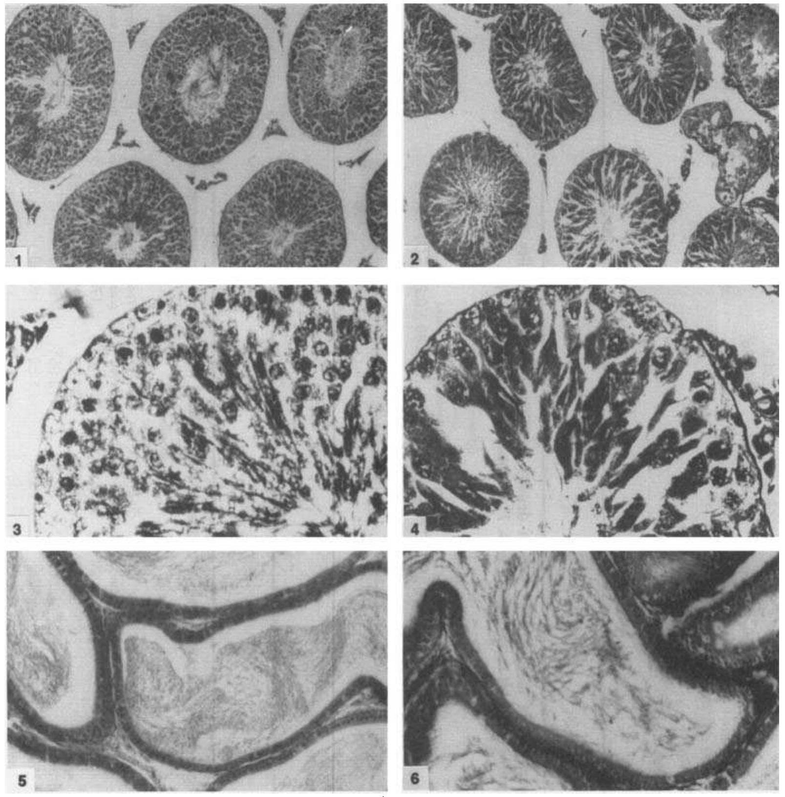 S 1-6. histoarchitecture of testis and cauda epididymis of