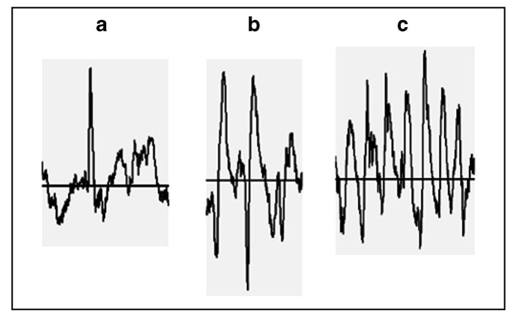 Representation of different types of spikes appeared in