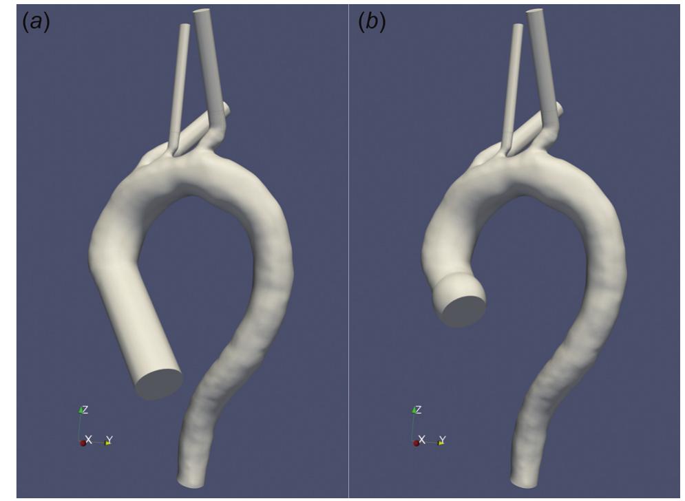 The derived geometries of the thoracic aorta with (a) inlet
