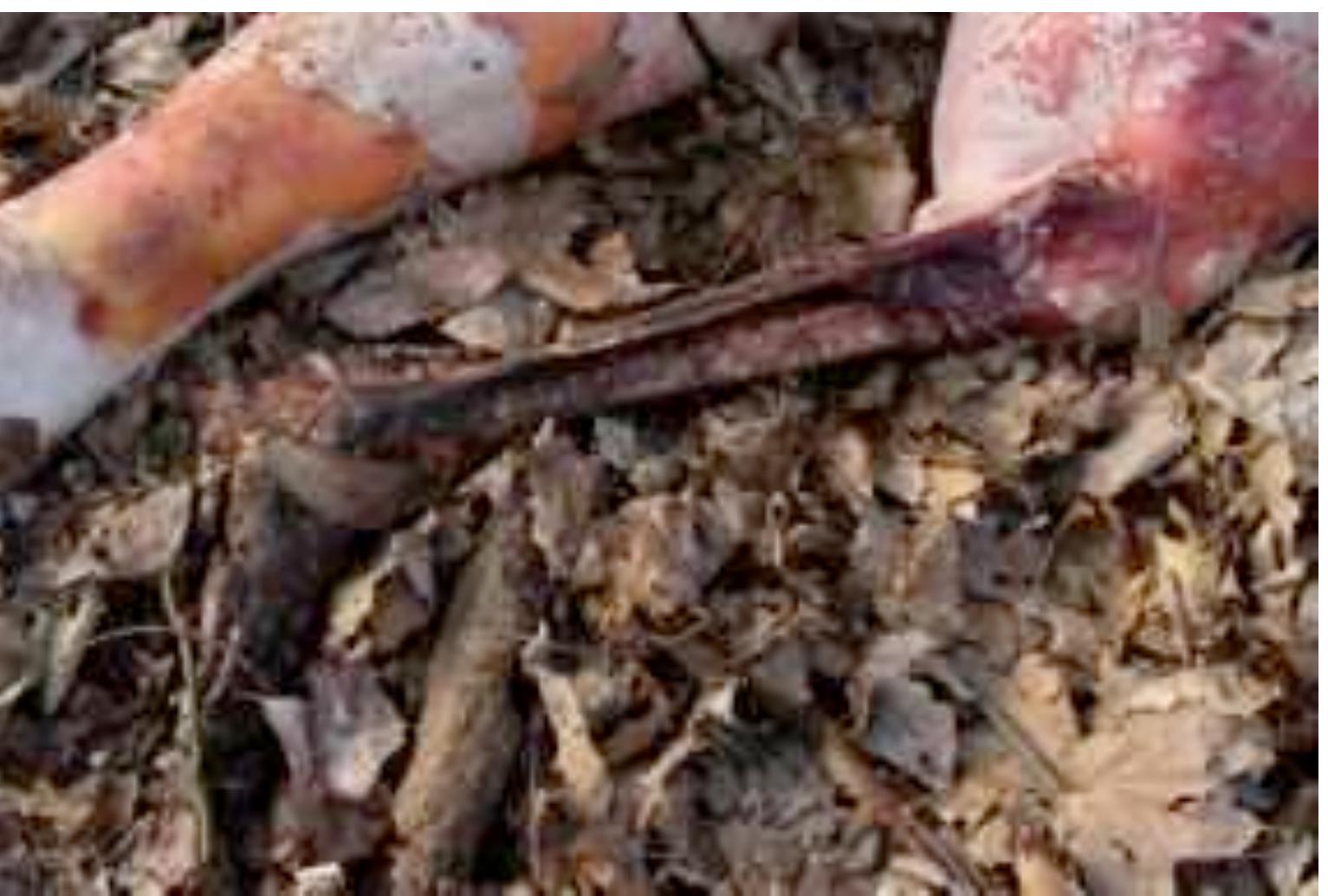 Defleshed right distal extremity. the epidermis was pulled