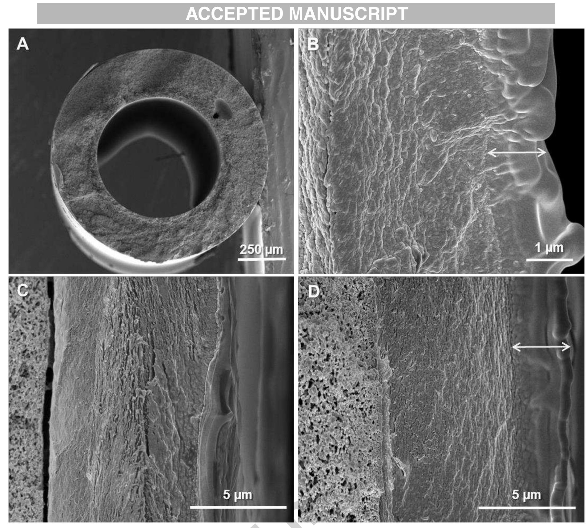 Sem images of the cross sections of hollow fiber