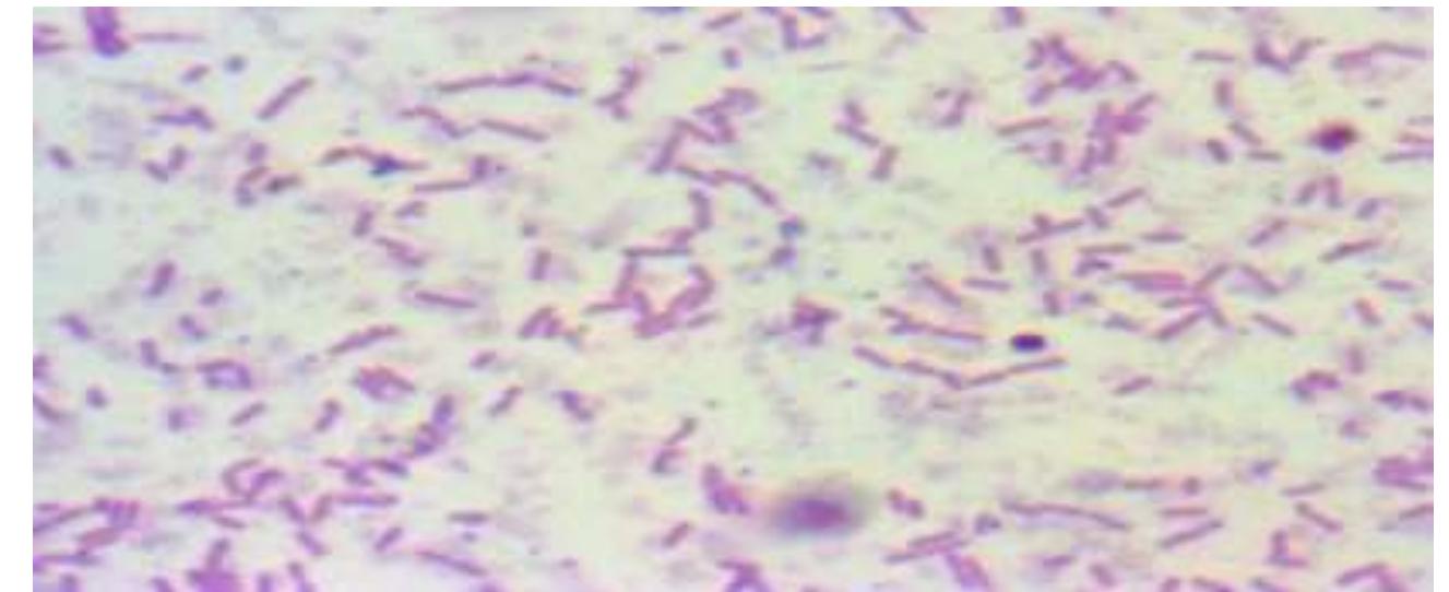 (1) gram positive rods of bacillus subtilis , under light