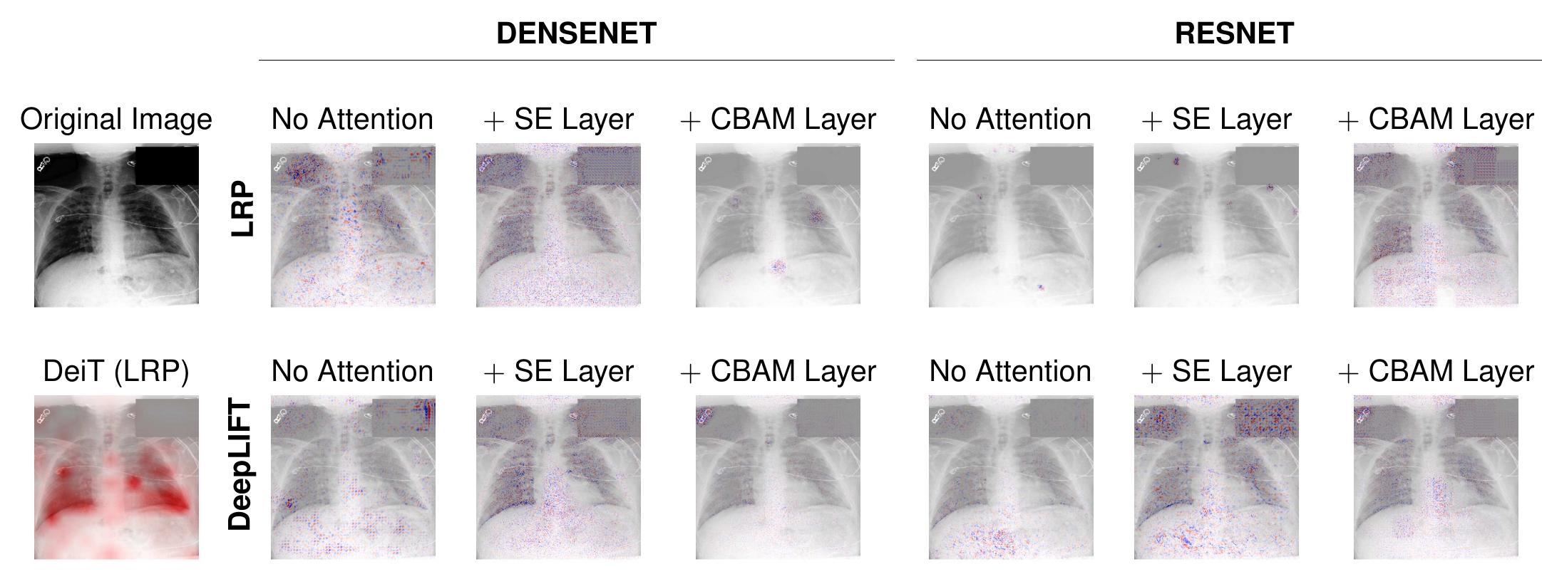 Example of lrp and deeplift post-hoc saliency maps for an