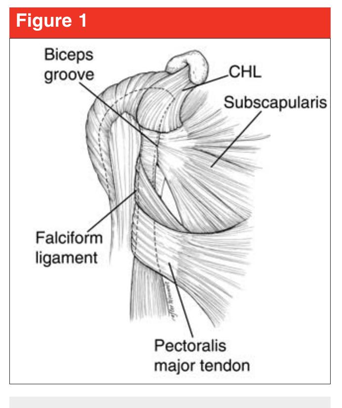 Figure 1 - Long Head of the Biceps Tendinopathy: Diagnosis