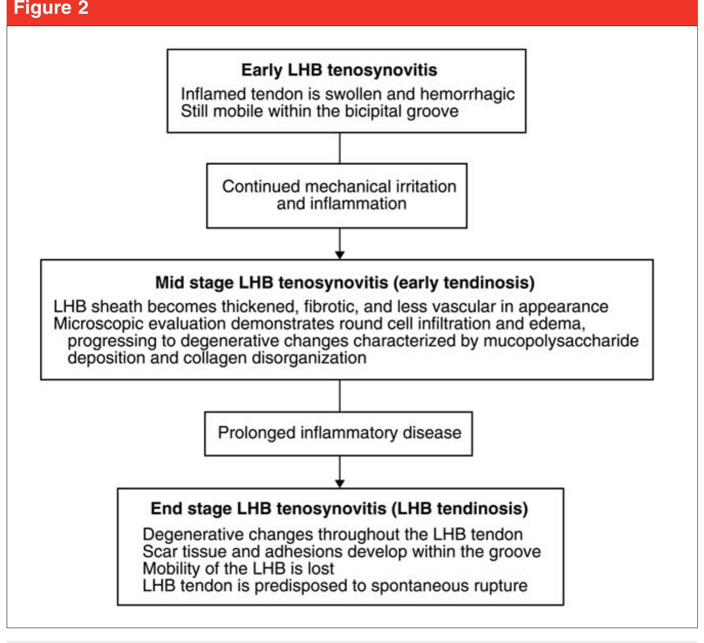 Algorithm demonstrating the pathophysiology of long head of