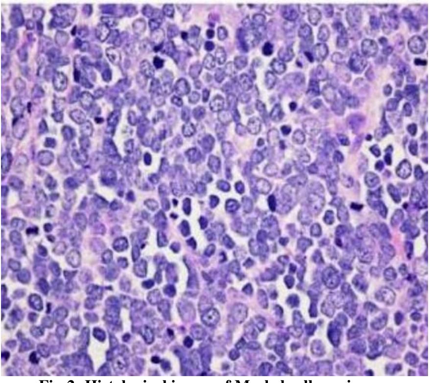 Figure 2 - Study of Ophthalmic Lesions: Diagnostic Utility