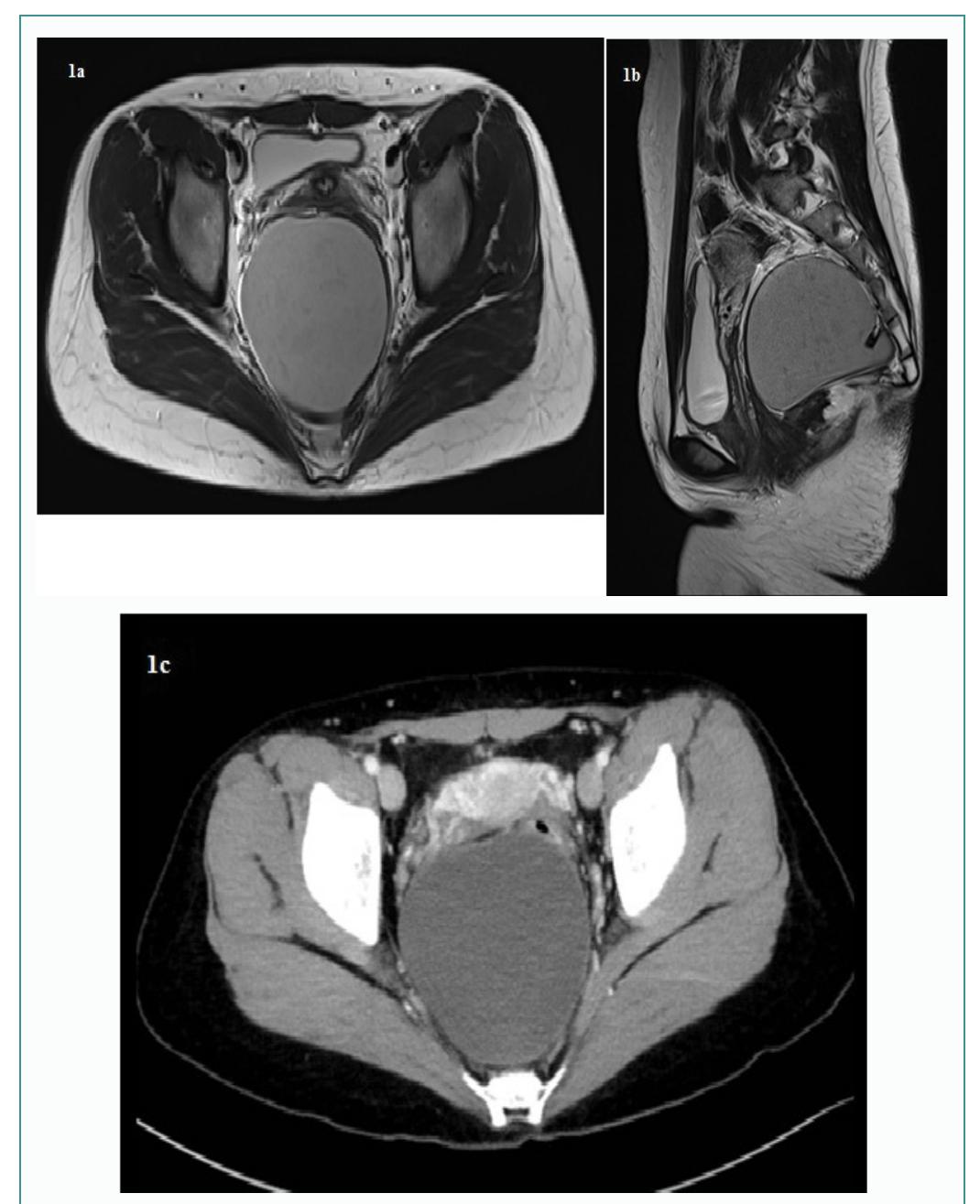 (a, b). axial and sagittal views of t2-weighted blade turbo