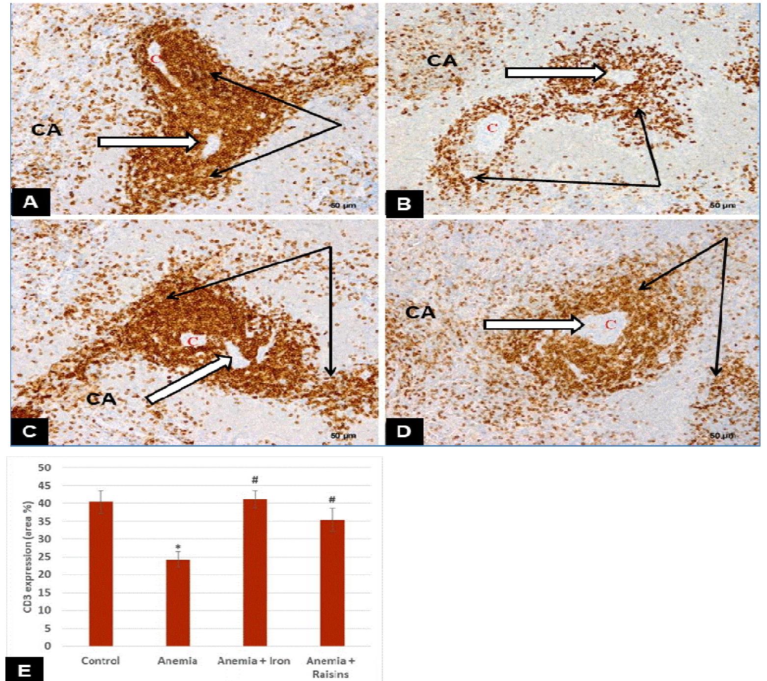 Photomicrographs of t lymphocytes cd3+ immunostaining of